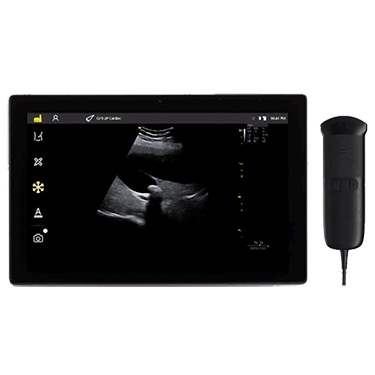 Ultrasonido portátil Vinno Q Series