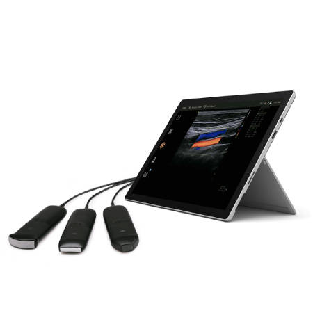 Ultrasonido portátil Vinno Q Series